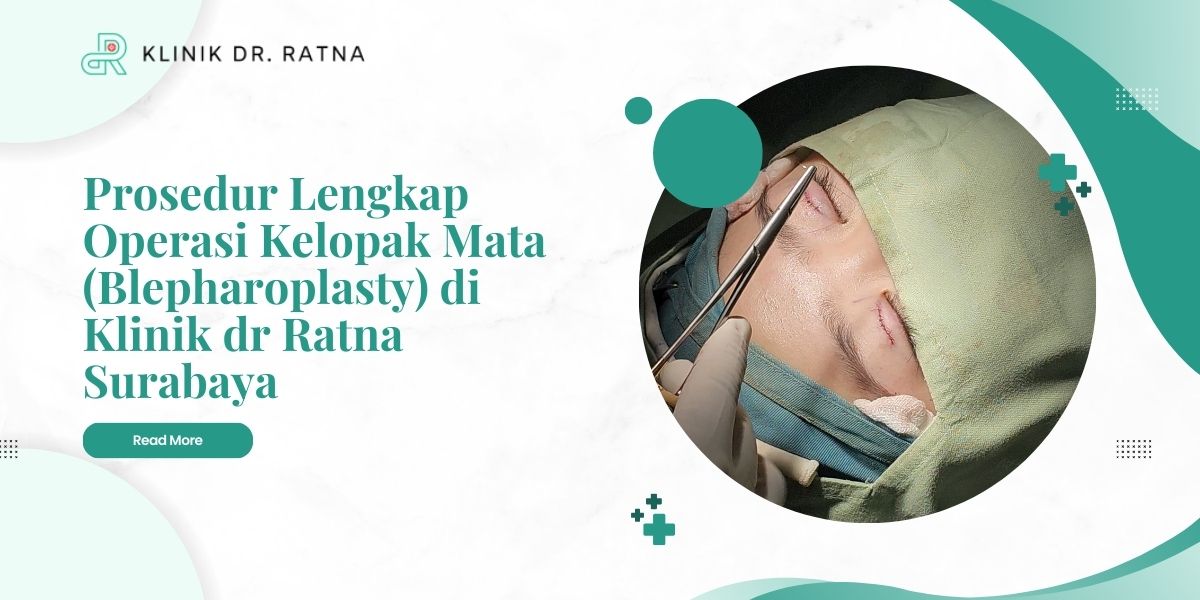 Prosedur Lengkap Operasi Kelopak Mata (Blepharoplasty) Di Klinik Dr ...